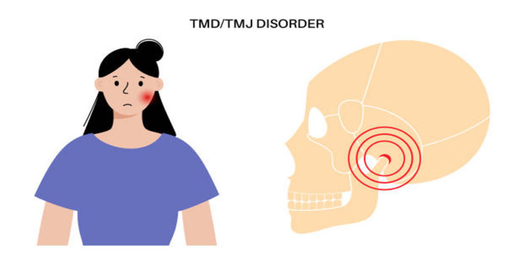 TMJ Symptoms: Complete Awareness, Signs, Causes and Prevention